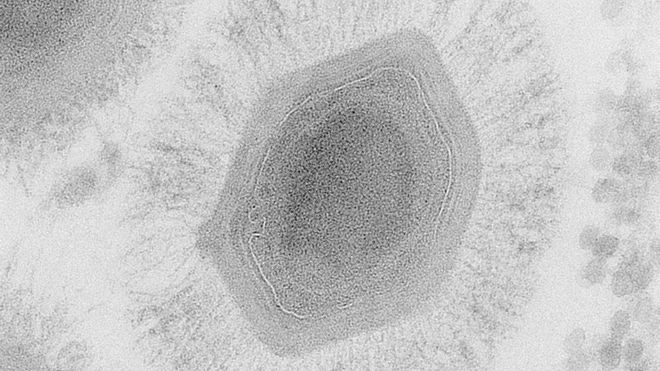 I virus e l'origine degli eucarioti - Le Scienze
