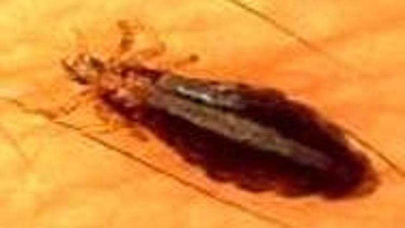 La genetica dei pidocchi racconta la storia degli esseri umani - Le Scienze