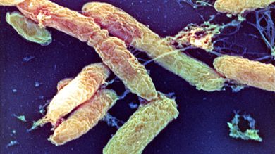 La peste bubbonica ha lasciato cicatrici durature nel genoma umano - Le ...