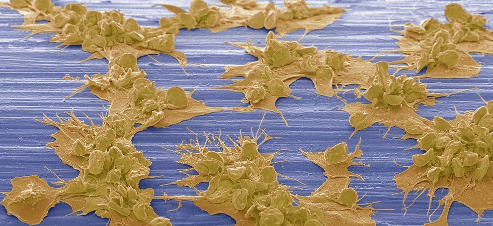 Le piastrine aiutano a ringiovanire il cervello - Le Scienze