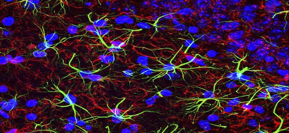 La più ricca mappa del cervello umano mai realizzata - Le Scienze